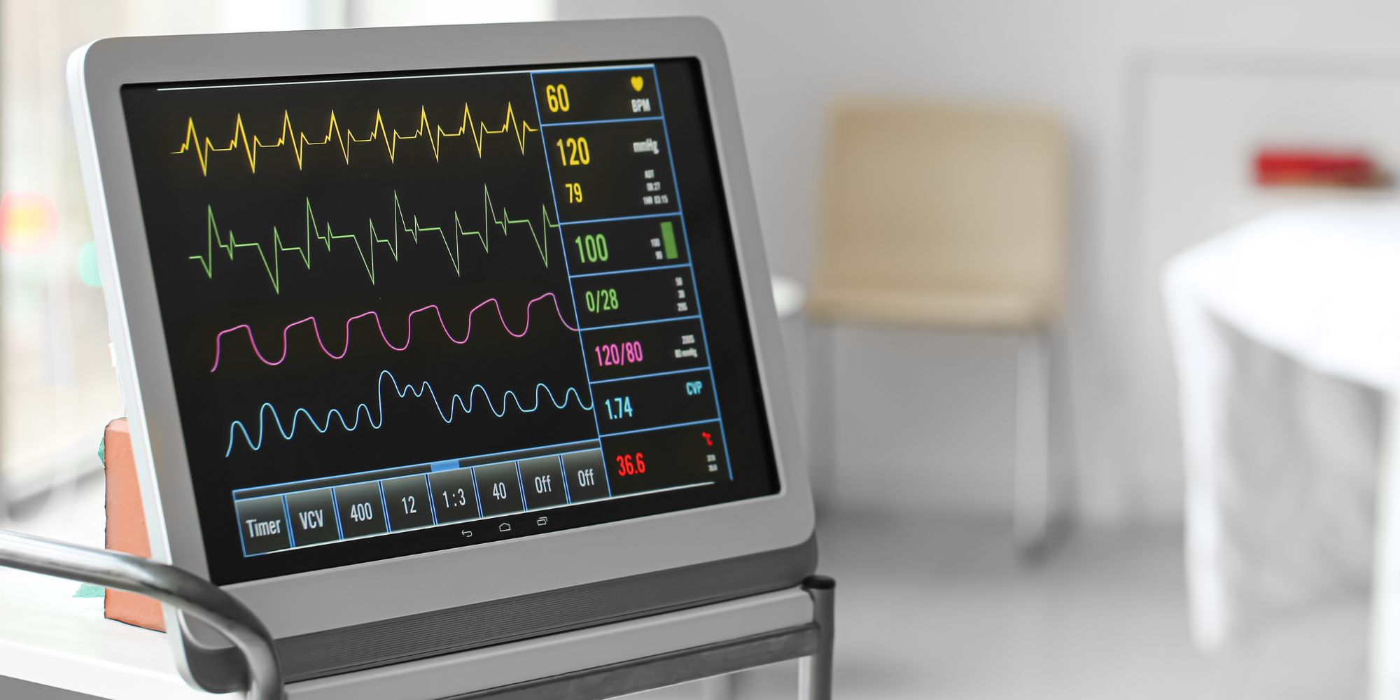 Top Factors to Consider When Choosing CO2 Monitors for Your Clinic or ...